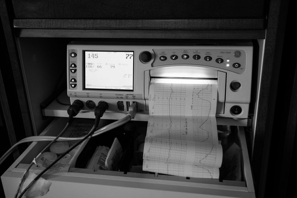 Intermittent Auscultation – Midwife